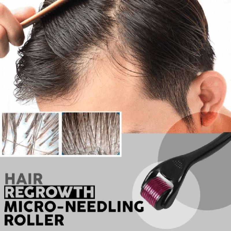 Premium Titanium Microneedle Derma Roller – Soho Emporium